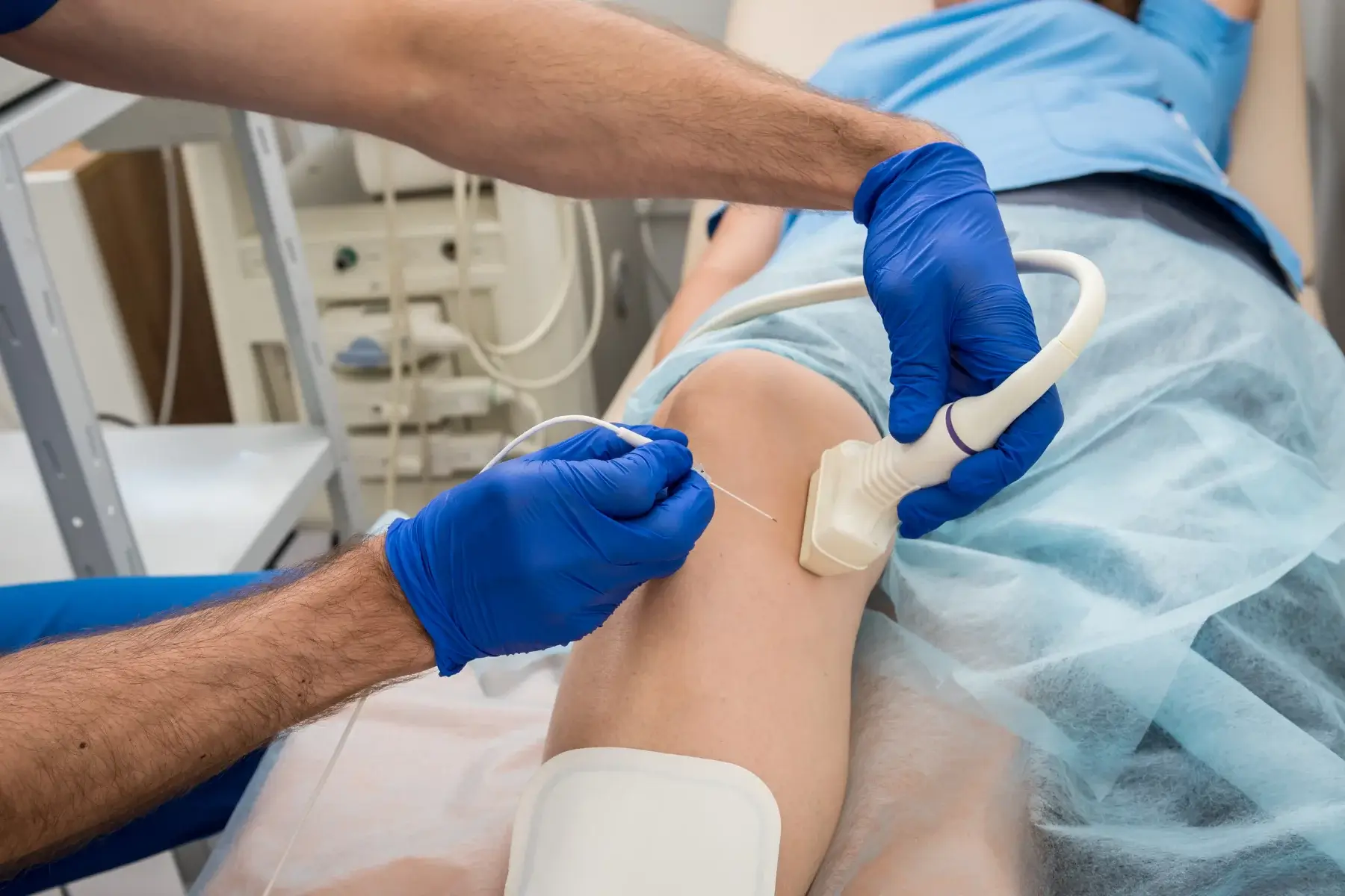 What Is The Success Rate Of Radiofrequency Ablation FMPM