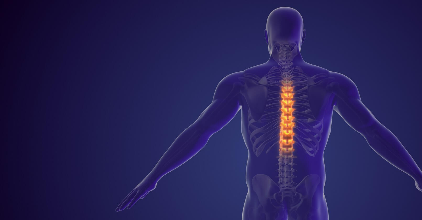 Spinal Cord Stimulation Spring Hill FL | FMPM | Pain Specialist